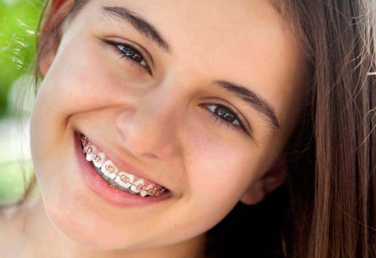 ¿Qué son Ataches Dentales? Ortodoncia Invisible y otros Tratamientos ...