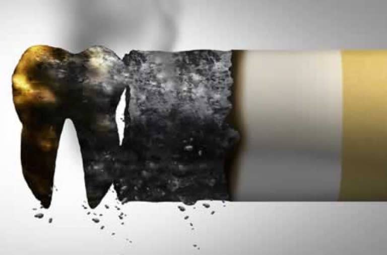 Sarro negro, ¿Qué es? ¿Cómo se forma? | Clínica Dental en VALENCIA ...