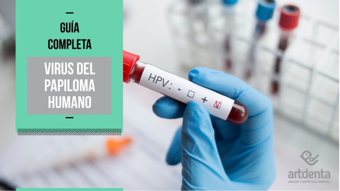 Virus del Papiloma Humano (VPH) Bucal: Guía Completa | Clínica Dental ...