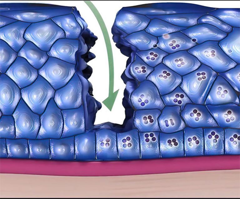 Virus del Papiloma Humano (VPH) Bucal: Guía Completa | Clínica Dental ...
