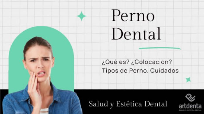 ¿Qué es un Perno Dental? Colocación. Tipos de Pernos. | Clínica Dental ... ¿Qué es un Perno Dental? Colocación. Tipos de Pernos. | Clínica Dental ...