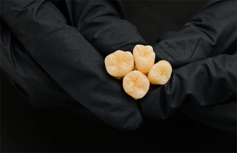 Forceps Dental. Tipos. Clasificación. Extracciones. | Clínica Dental en ...