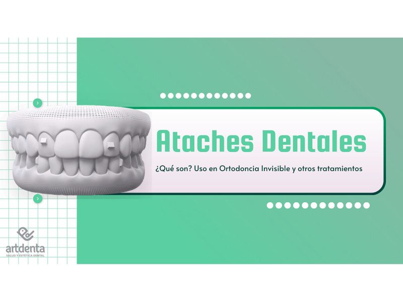 ¿Qué son Ataches Dentales? Ortodoncia Invisible y otros Tratamientos ...